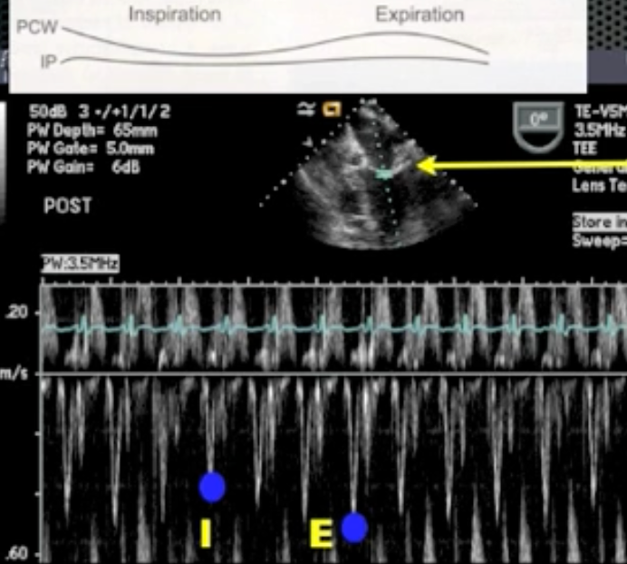 TTE Clinical Ultrasound - Clinics in Medical Education